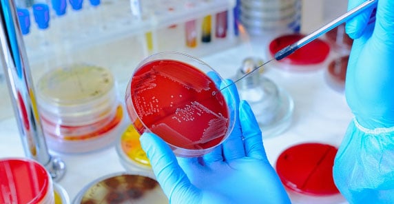 Life Sciences - Microbiology Solutions | AnalytiChem